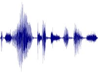 Speech as highly complex sound signal