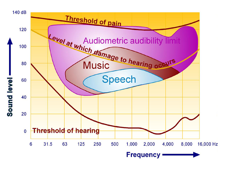 Abnormal audiometric audibility limit